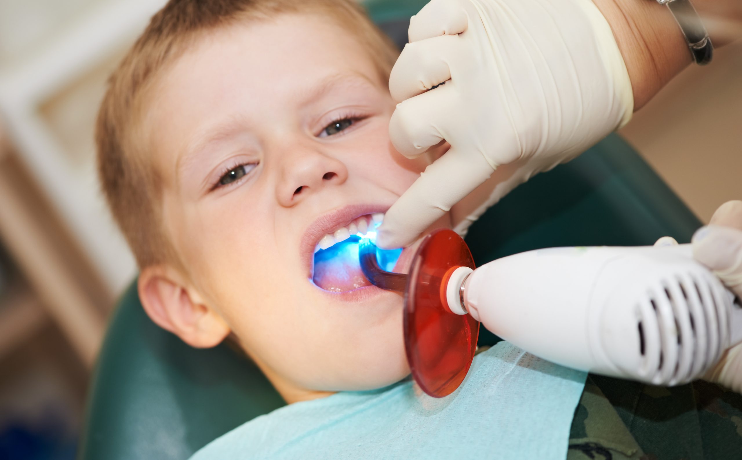 How We Place Your Child’s Dental Filling | Dallas, TX