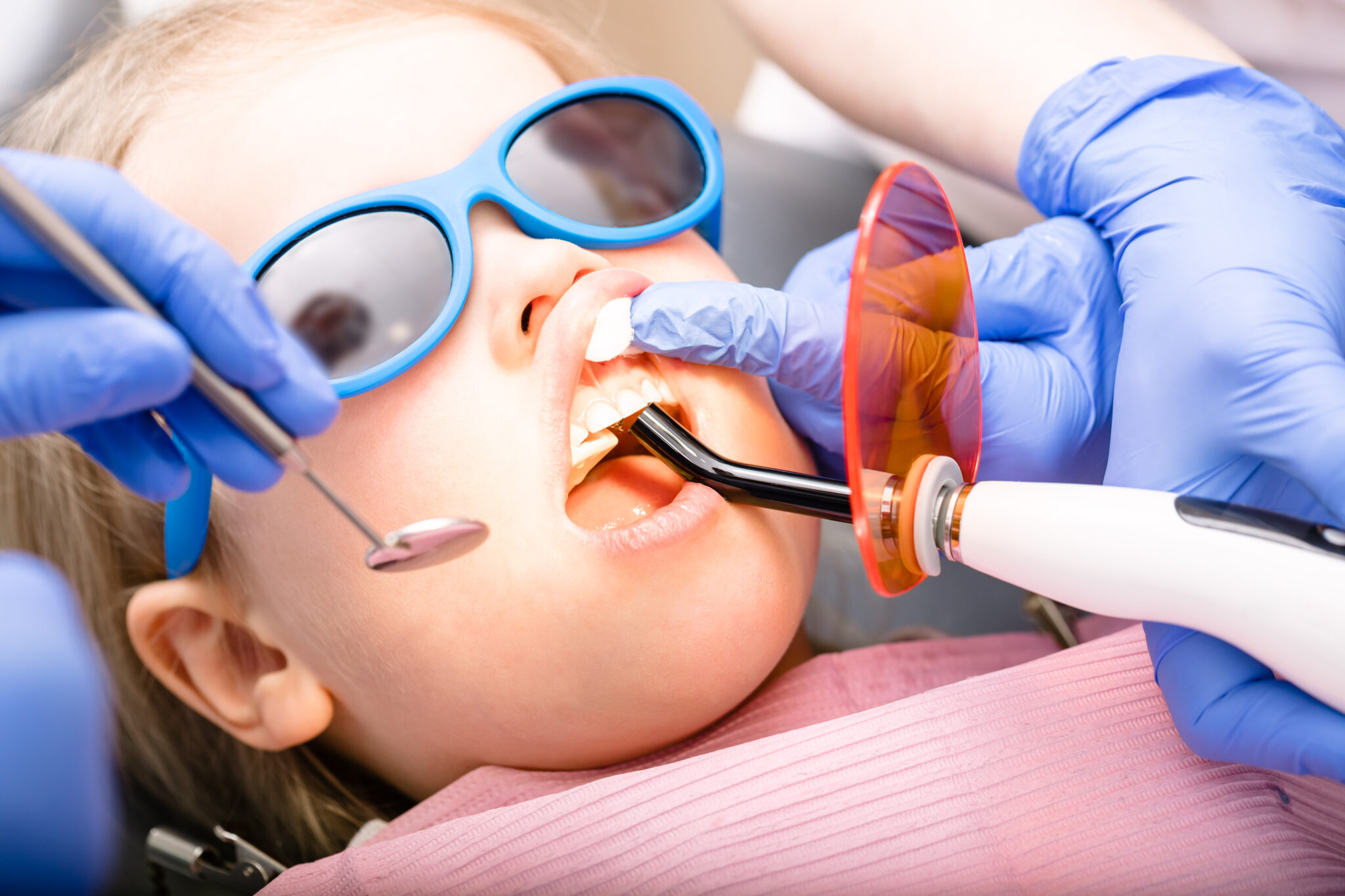 Placing Safe Fillings For Kids | Dallas, TX