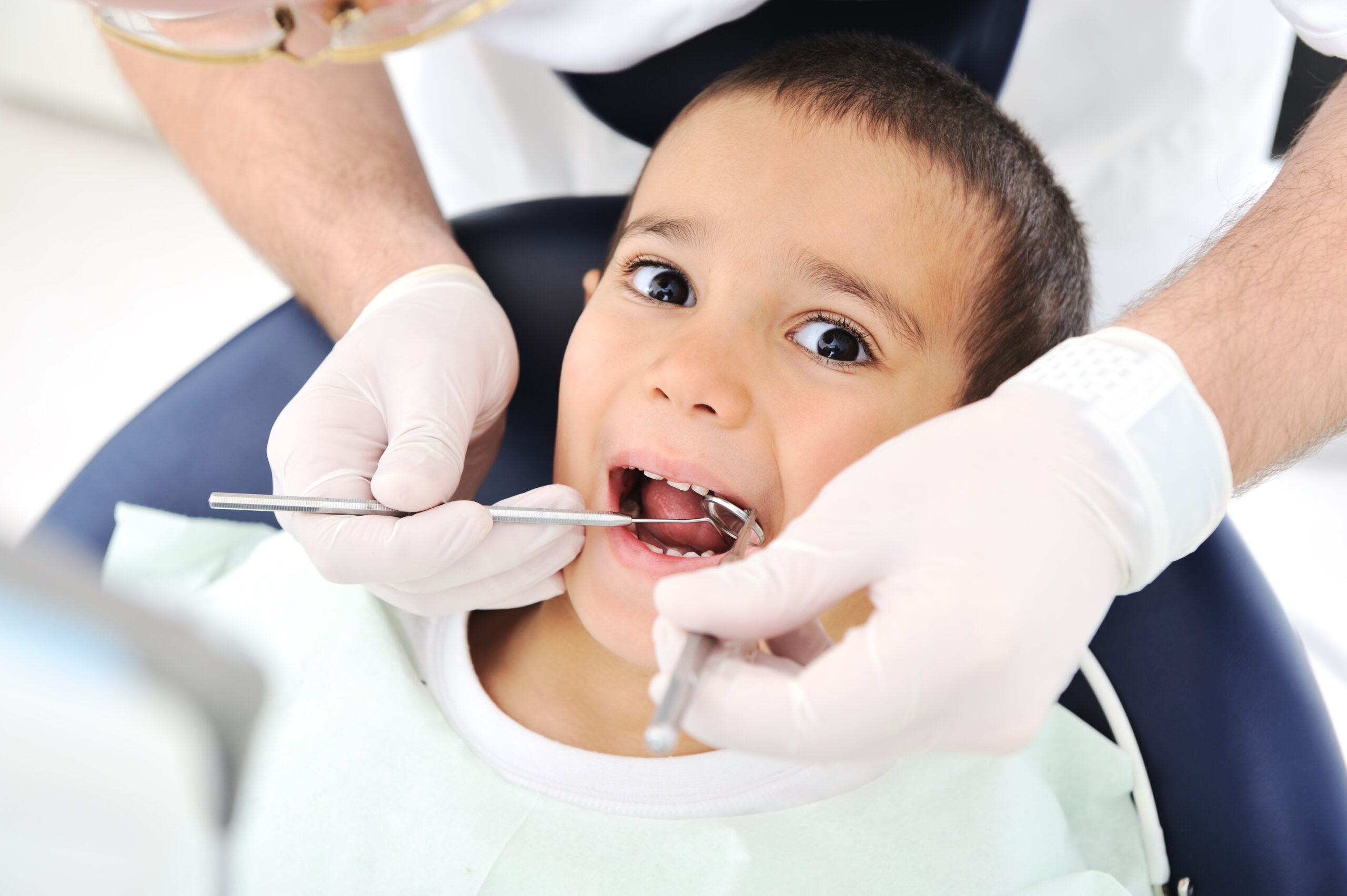 Why Some Kids May Need Tooth Extraction | Dallas, TX