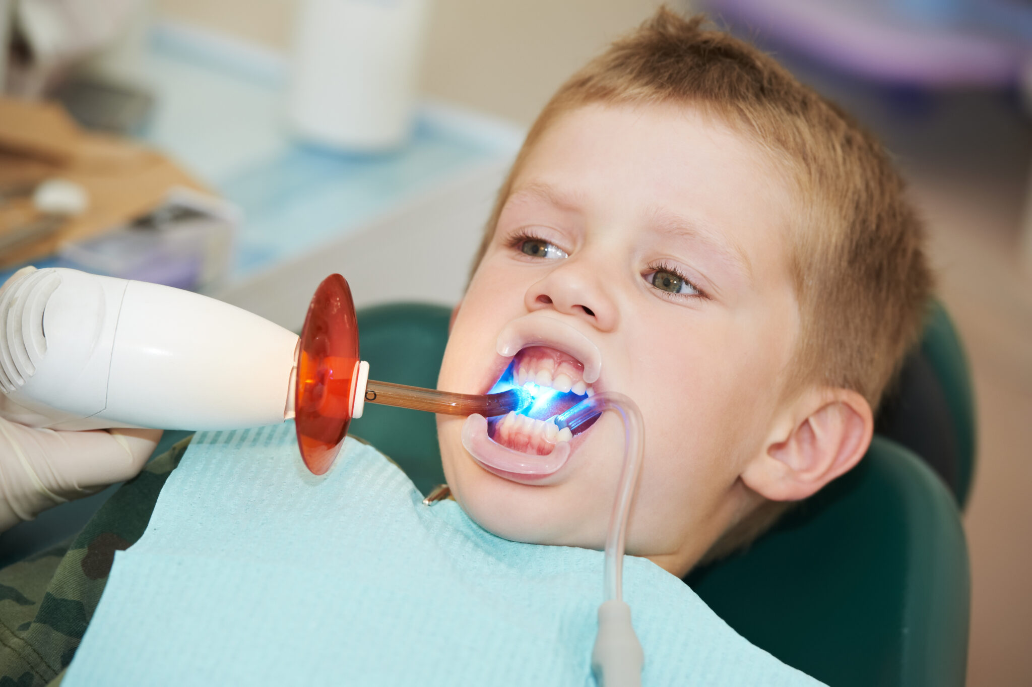 Helping Children With Composite Fillings | Dallas, TX