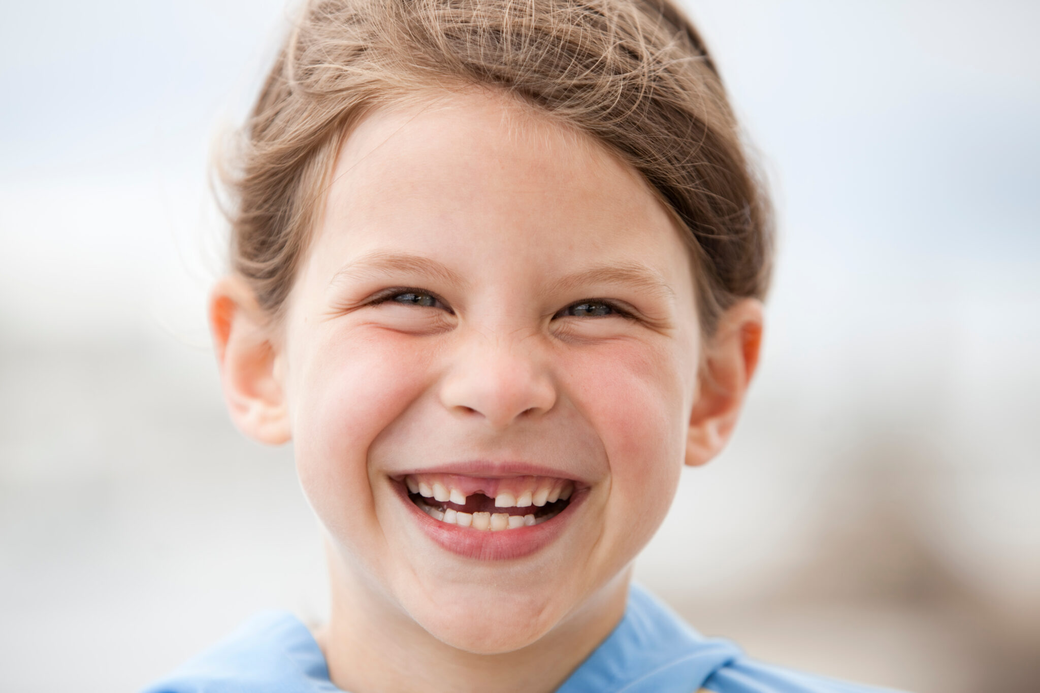 When Does A Child Need A Tooth Extraction? | Dallas, TX